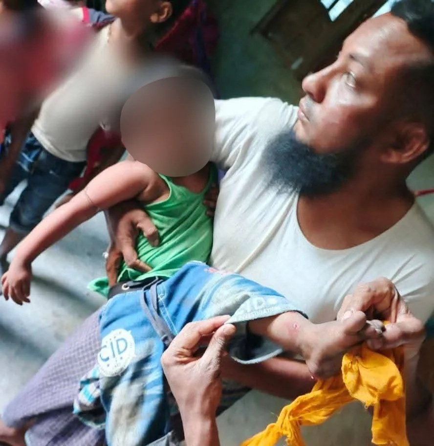 မောင်တောတွင် မိုင်းနင်း၍ အသက် ၂ နှစ်အရွယ်ကလေးတစ်ဦးအပါအဝင် ၃ ဦး ဒဏ်ရာရ